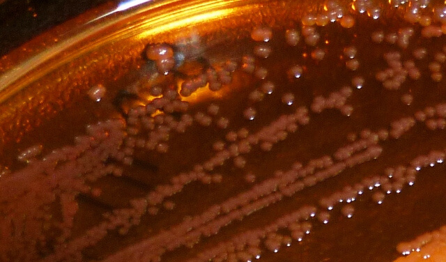 Dirty Dozen: Here Are the World’s Most Dangerous Bacteria