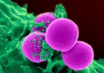 Dirty Dozen: Here Are the World’s Most Dangerous Bacteria