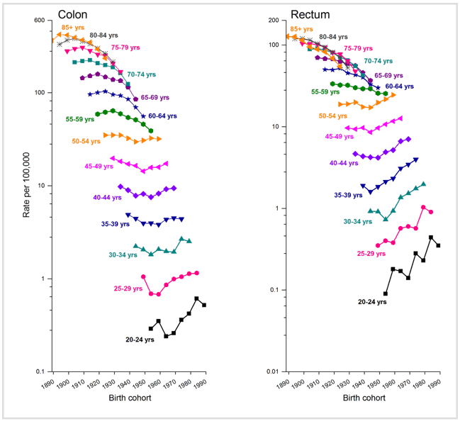Colon Cancer Rates Are Increasing Among Millennials