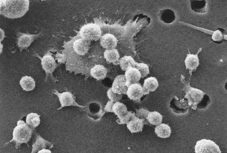 Can Setting Off Nano Explosions Within the Body Kill Cancer Cells?