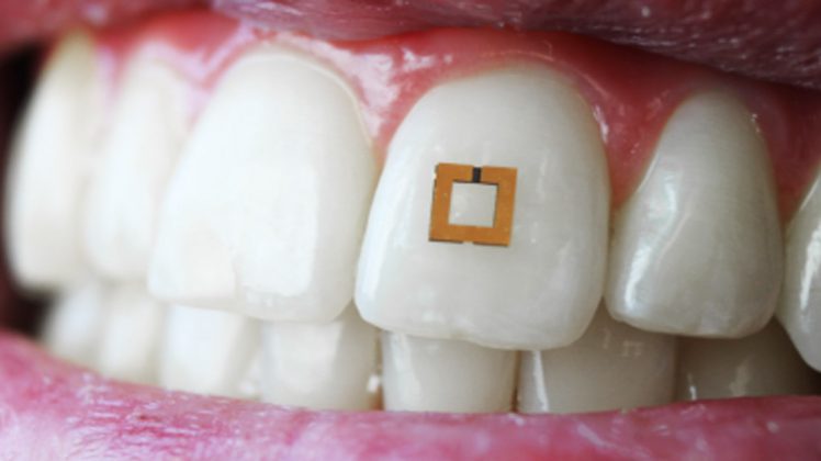 Scientists Create Sensor That Can Track What You Eat